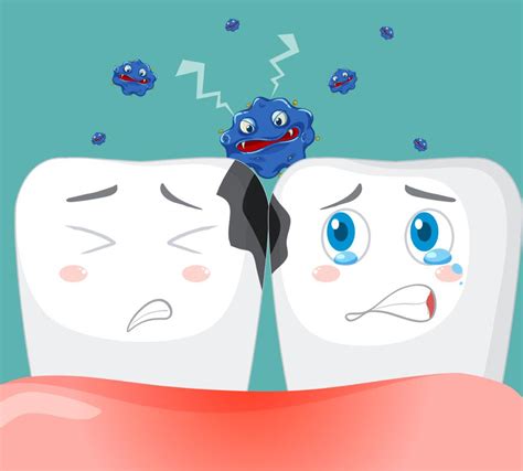 How To Fix Cavities Between Teeth Manadr