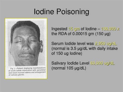 Ppt Adaptive Innovations In Surgery Vitamin D Iodine And Selenium