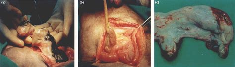 Midline Laparotomy In The Cat Showing A A Fully Formed Kitten Free In