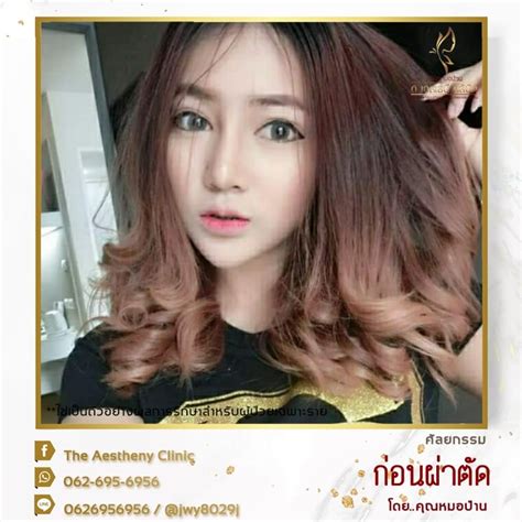 รีวิว ตกแต่งตาสองชั้น แก้ไขหนังตาตก แก้ไขถุงใต้ตา 🚩the Aestheny Plastic Surgery Clinic By Dr