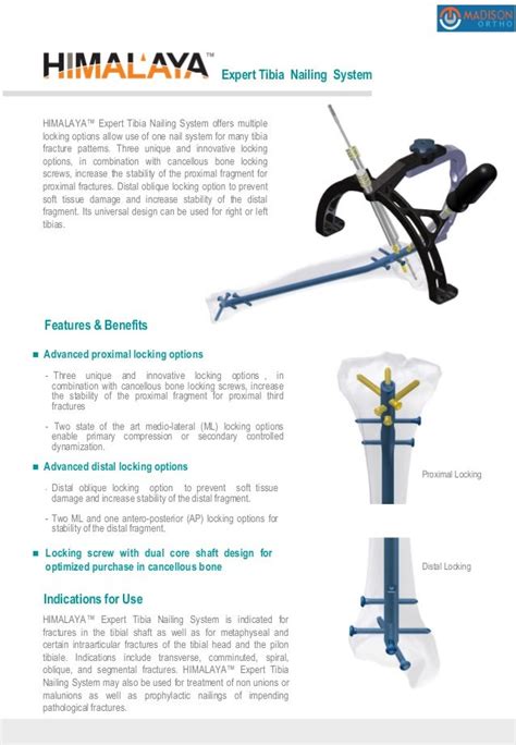 Himalaya™ Expert Tibia Nailing System Himalaya™ Expert Tibia Nailing System