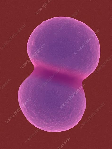 Staphylococcus Aureus SEM Stock Image C032 2064 Science Photo Library