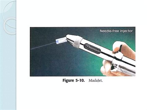 Technique Of Mandibular Anesthesia Pptx