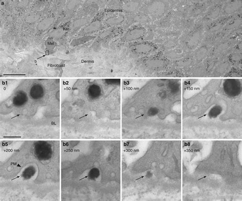 Transmission Electron Microscopy Tem Of Ultrathin Sections Of Human Download Scientific