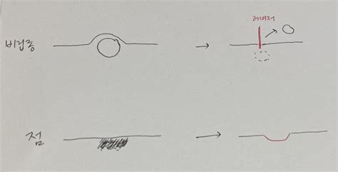 피부과전문의가 알려주는 비립종 Feat 좁쌀여드름이랑 뭐가 달라 바르는 걸로 치료가 될까 네이버 블로그