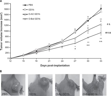 Neurostatins Inhibit Experimental Glioma Growth In Nude Mice A