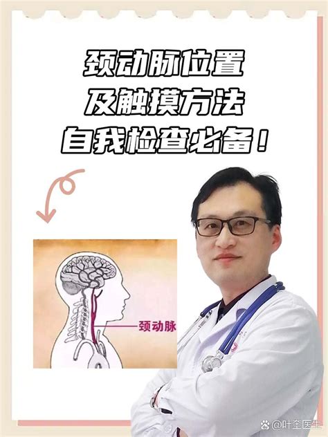 颈动脉位置及触摸方法，自我检查必备！