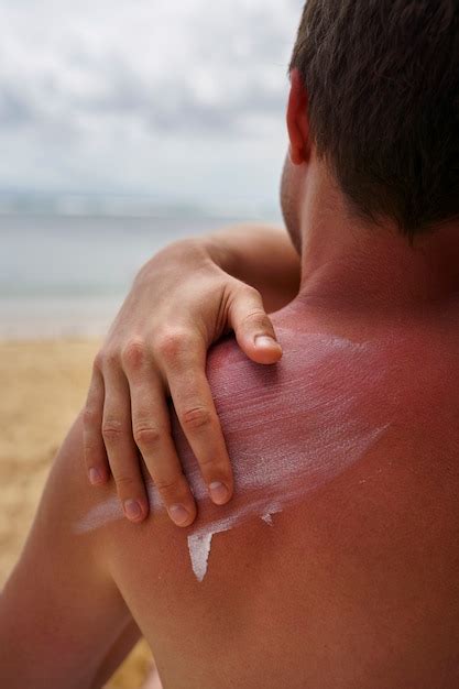 Neck Sunburn Images Free Download On Freepik