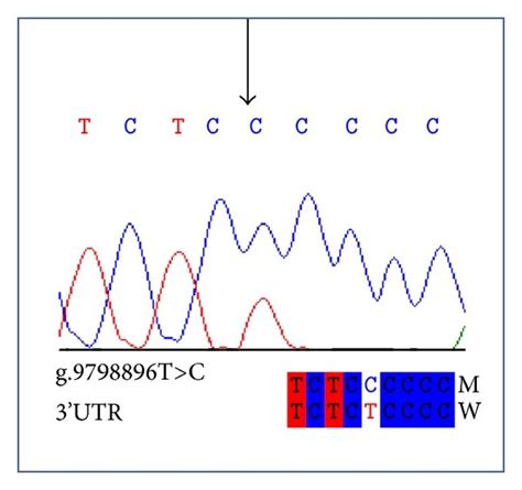 Sequencing Electropherogram Of Polymorphisms Of Ogg1 A B C