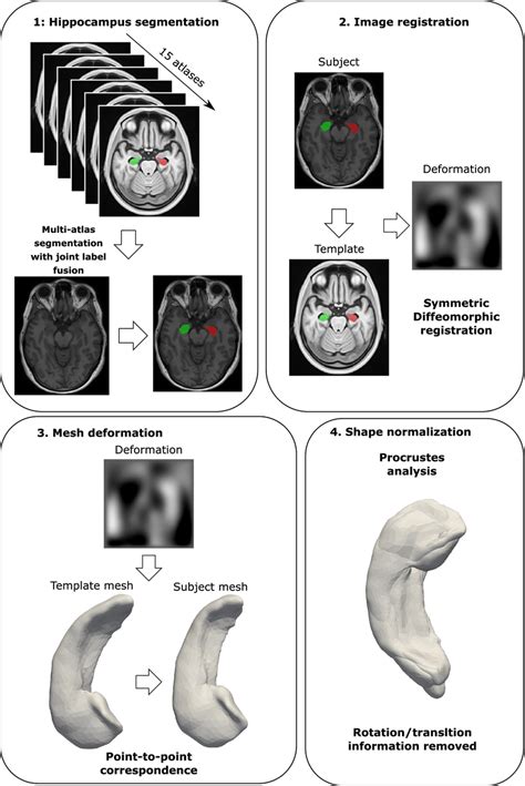 Outline Of The Processing Pipeline Download Scientific Diagram