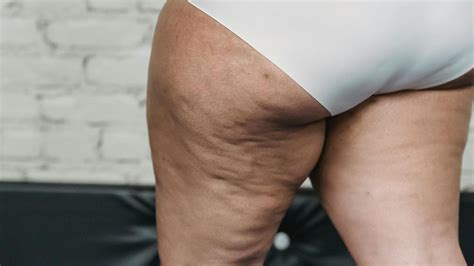 Bylo Jí 43 Mně 23 Chtěla Jen Sex Je Překvapivé Na čem Stál A Padal Náš Vztah Médium Cz