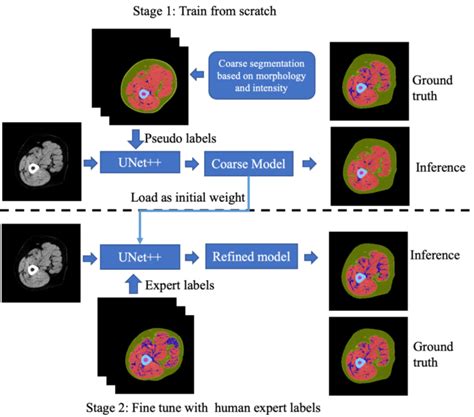 Quantification Of Muscle Bones And Fat On Single Slice Thigh Ct Medical Image Analysis And