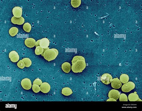 Color Ehanced Scanning Electron Micrograph SEM Of Staphylococcus
