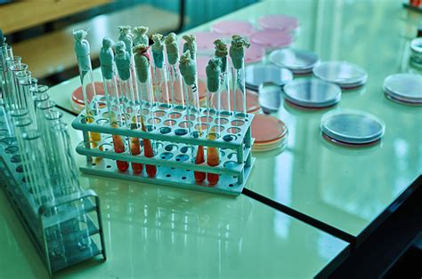 다양한 배양 배지 시험관 미생물학 박테리아 대학 실험실 0명에 대한 스톡 사진 및 기타 이미지 0명 Stem 주제 건강 진단 Istock