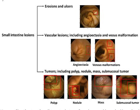 Table 1 From Improved Object Detection Artificial Intelligence Using