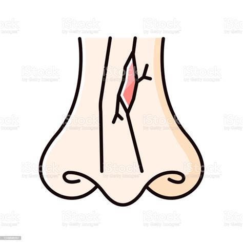 비강 골절 Rgb 색상 아이콘 부러진 코 뼈 코 연골에 균열 안면 부상 외상 사고 건강 상태 의료 격리된 벡터 그림 개념에 대한 스톡 벡터 아트 및 기타 이미지 Istock