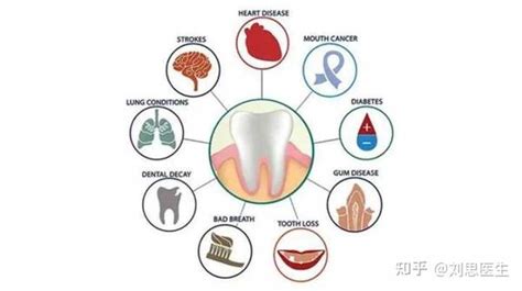 全身健康，从牙齿开始！ 知乎