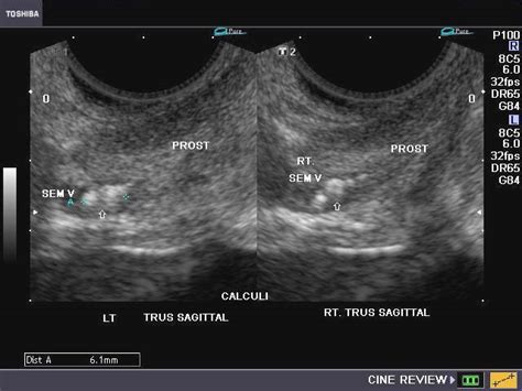 A Gallery Of High Resolution Ultrasound Color Doppler And 3d Images