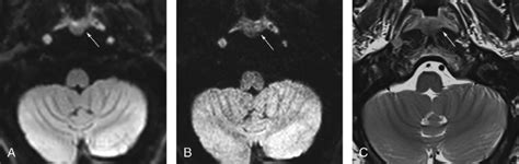 At The Same Level Rs Dwi A Sms Rs Dwi B And Tse T2wi C Show A