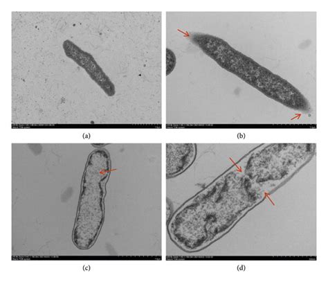 Scanning Electron Micrographs Of The Effects Of Cinnamaldehyde Notes