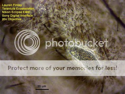 Under The Microscope Page 2 Arachnoboards