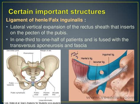 Inguinal Hernia Ppt