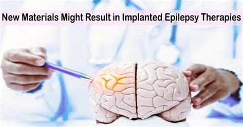 New Materials Might Result In Implanted Epilepsy Therapies Assignment Point
