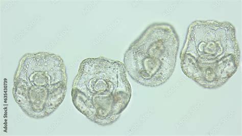 Larvae Sea Urchin Strongylocentrotus Pallidus Under Microscope Phylum Echinodermata Prism