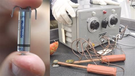 Todays Tiny Pacemakers Have Roots In A Canadian Invention Youtube