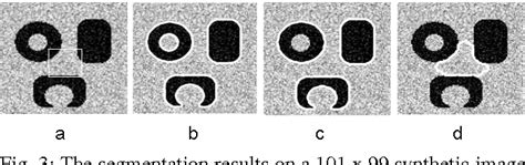 Figure 3 From Active Contour Model Driven By Globally Signed Region Pressure Force Semantic