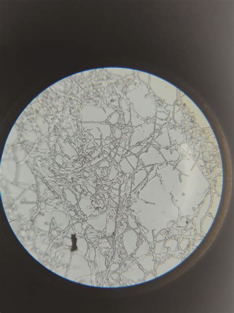 Is This Scoby Rkombucha