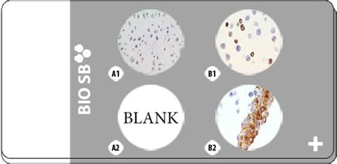 Cancer Human Cell Line Microarrays