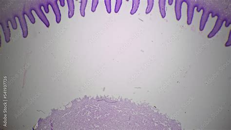Agaricus In Section Magnified In 40 Times Under Microscope In