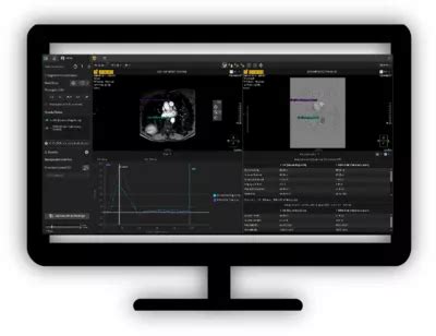 Philips MR Qflow Visualizing And Quantifying Blood Flow Dynamics