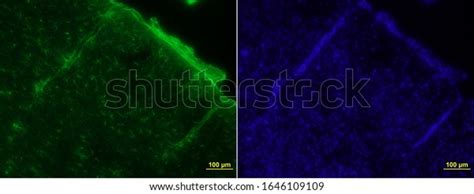 Photo Astrocytes Brain Glial Cells Marked库存照片1646109109 Shutterstock