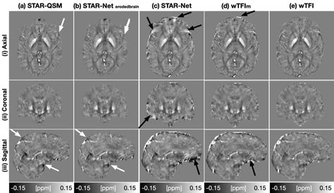 Showed Qsm Estimates Of A Single Orientation Dataset Star Net In Download Scientific Diagram