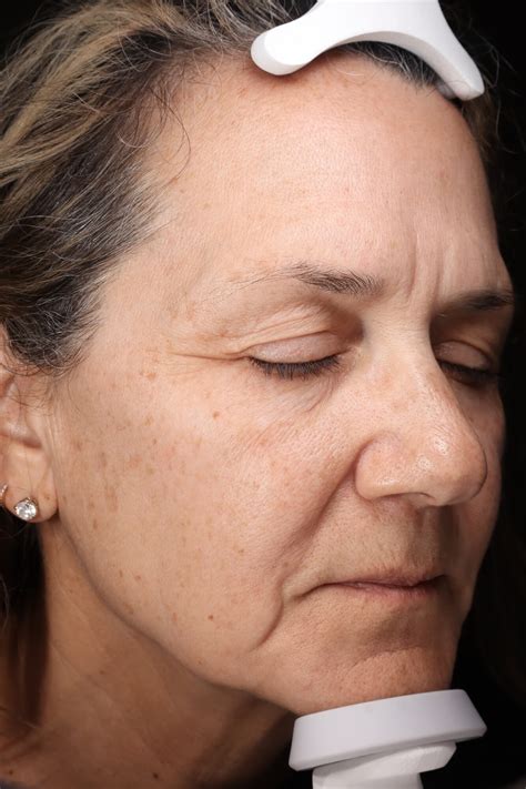 Moxi And Bbl Hero • Elinea