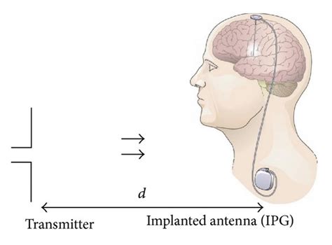 The Layout Of Communication Link Between The External Transmitter And Download Scientific
