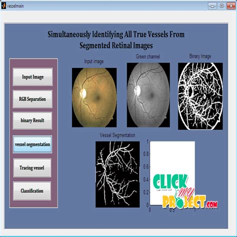 Simultaneously Identifying All True Vessels From Segmented Retinal
