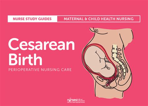 Cesarean Birth C Section Nursing Care And Management