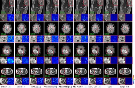 Figure 1 From Rethinking Diffusion Model For Multi Contrast Mri Super Resolution Semantic Scholar