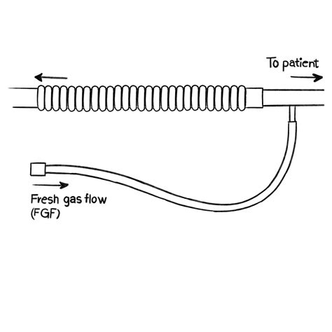 Marrow What Is The Type Of Circuit Shown In The Image A Mapleson C