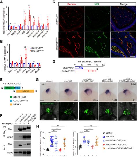 Stk24 And Stk25 Deletion Induces Ccms Via Mekk3 Klf2klf4 Signalling