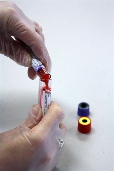 Center For Phlebotomy Education Your Labs Potassium Results