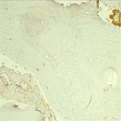 Expression Of Interferon Regulatory Factor 6 In Few Osteocytes Download Scientific Diagram