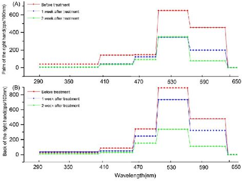 The Upe Spectral Distribution Of The Right Hand Of Type 2 Diabetes