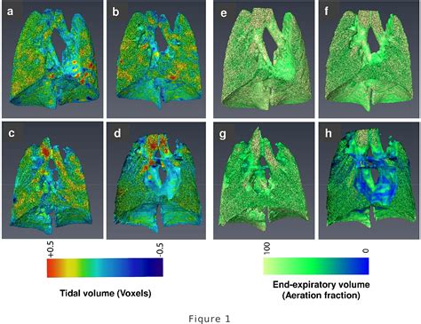 Figure 1 From The Proteomic Response Is Linked To Regional Lung Volumes