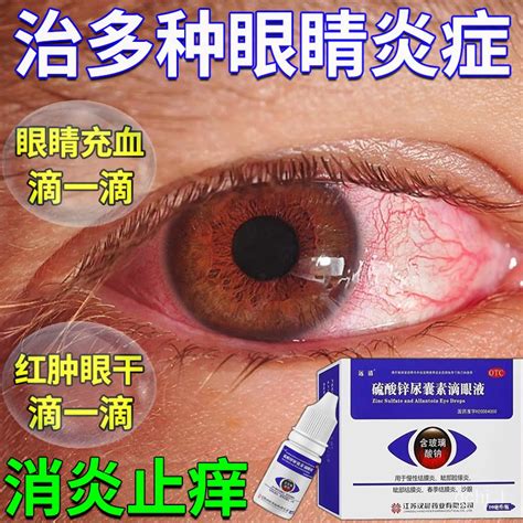 Ky Jd Eye Drops Anti Inflammatory Itching Sterilization Elderly