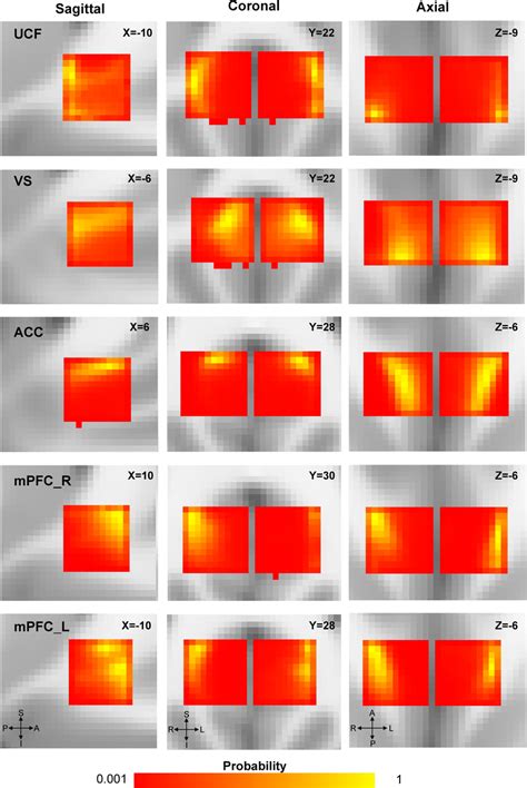 Average SCC Probabilistic Maps And Distribution Of Connectivity Across
