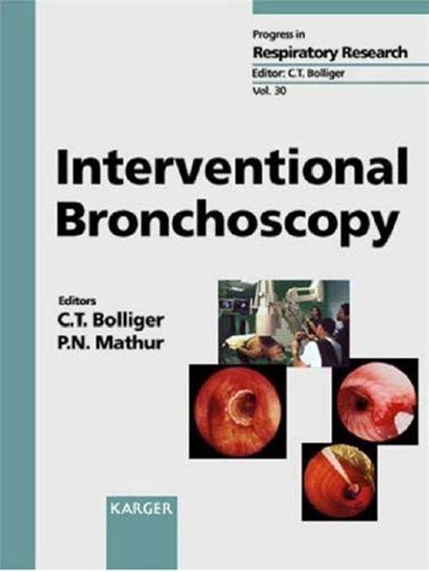 Interventional Bronchos Pdf Endoscopy Lung Cancer